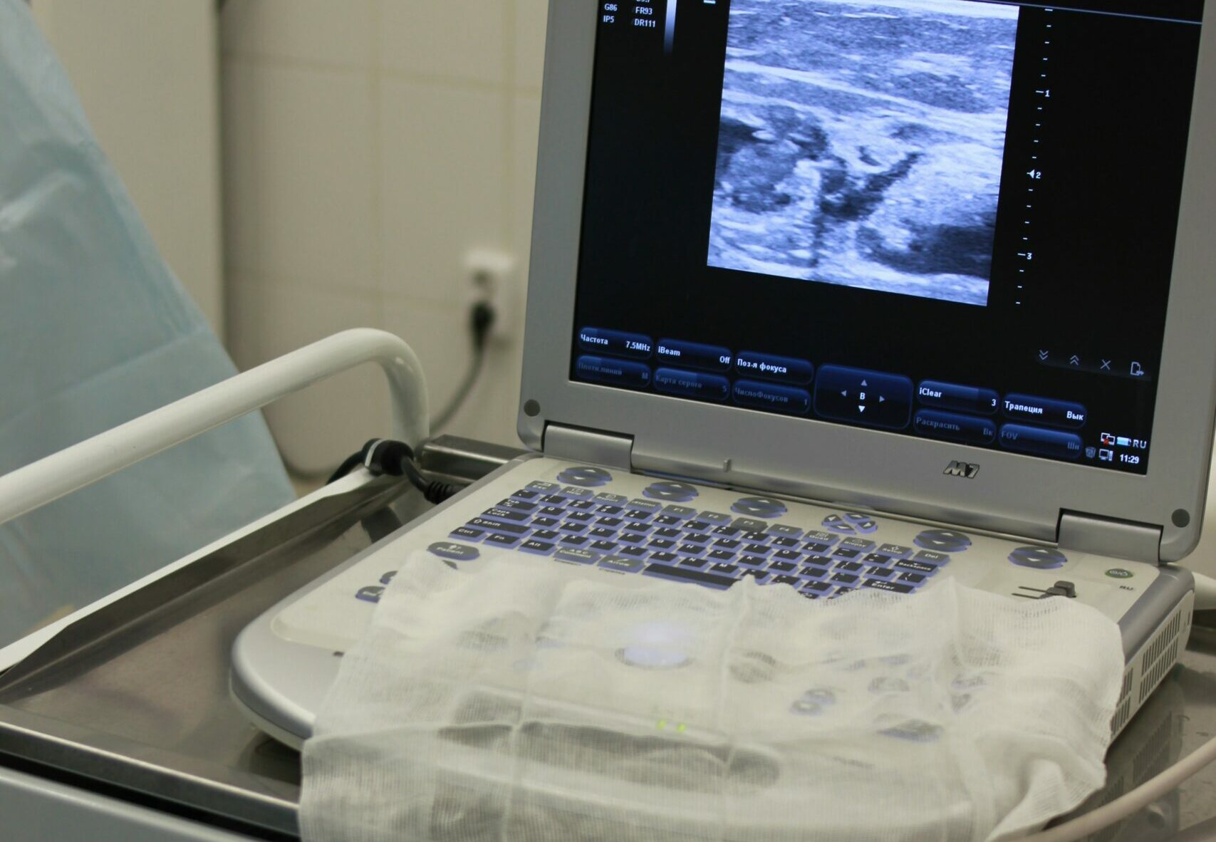 Sonogram in Early Pregnancy - The Keim Centers